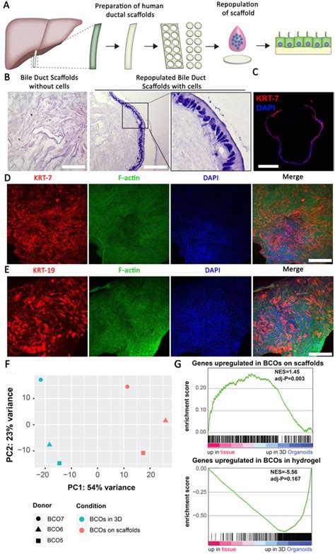 Cholangiocyte Organoids From Human Bile Retain A Local Phenotype And Can Repopulate Bile Ducts