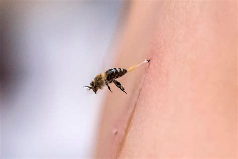 Bee Sting Therapy In Giza In Pictures