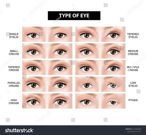 What Are The Different Types Of Eyelids? How To Determine Yours Easy Eye Makeup Tips | atelier ...