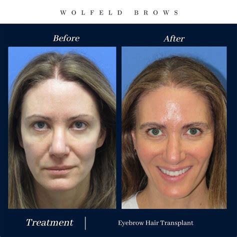 Here Are Two Before And After Photos Showcasing Excellent Results For One