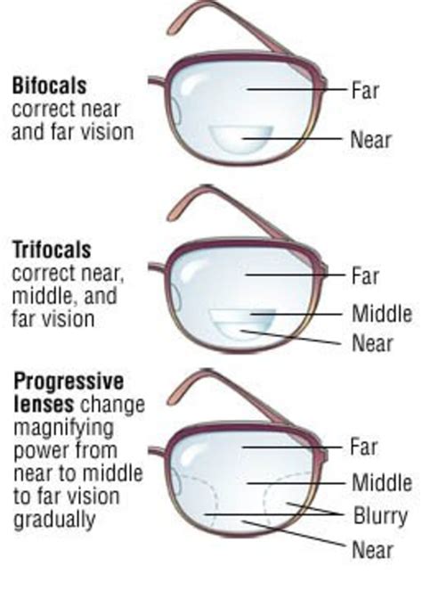 Bifocal Lens Design At Robert Thaler Blog