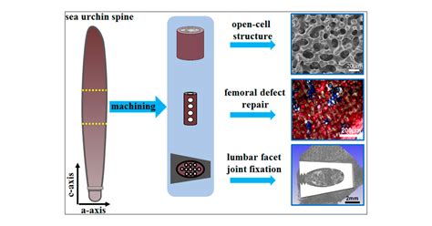 Lightweight Open Cell Scaffolds From Sea Urchin Spines With Superior