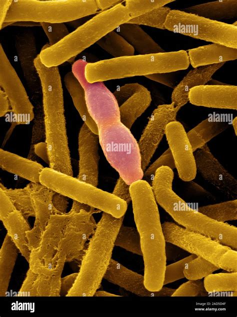 Coloured Scanning Electron Micrograph Sem Of Bacillus Anthracis Vegetative Stage And Spore