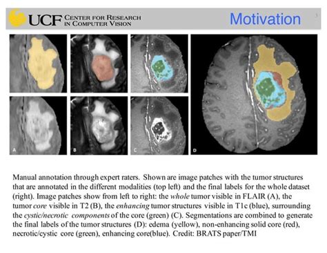 Lec10 Medical Image Segmentation As An Energy Minimization Problem Ppt