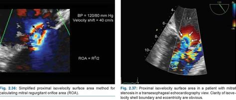 Hemodynamic Evaluation By Echo Doppler Techniques A Practical