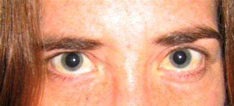 Big Pupils Casa Highland Flickr