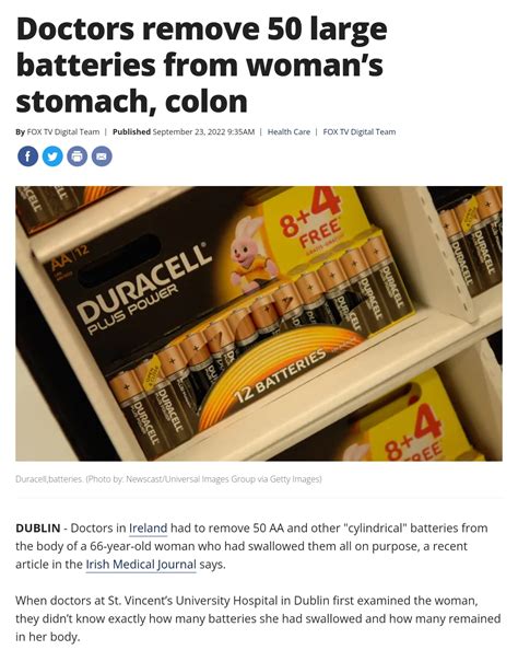 Doctors Remove 50 Large Batteries From Womans Stomach Colon Album