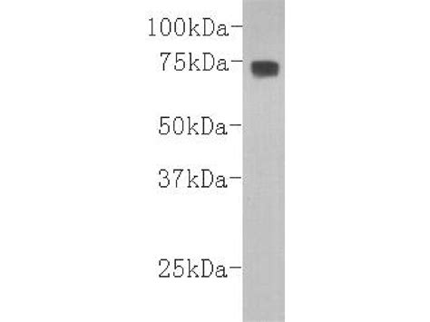 Complement C3β Chain Mouse Monoclonal Antibody 11 10 M0809 14