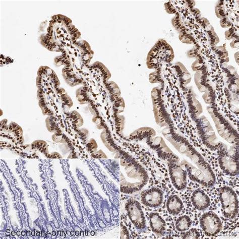 Ppar Alpha抗体 Epr21244 Ab245119 Abcam中文官网