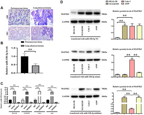 Mirna 338 3p Inhibits The Migration Invasion And Proliferation Of