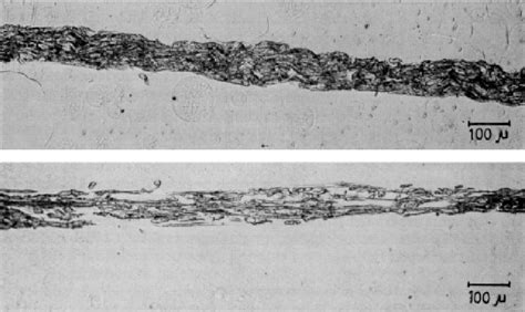 Cross Sectional Micrographs Of Compacted Paper Before Top And After