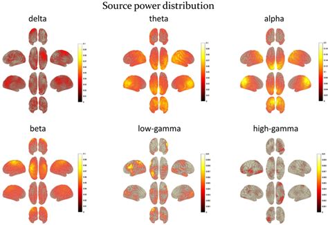 Color‐coded Brain Maps Of Source Power In Different Frequency Bands