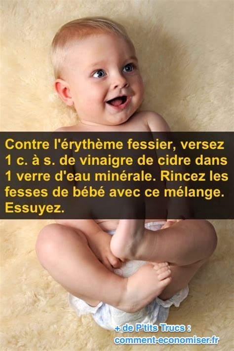 Bébé A Les Fesses Rouges Le Remède Naturel Qui Va Le Soulager