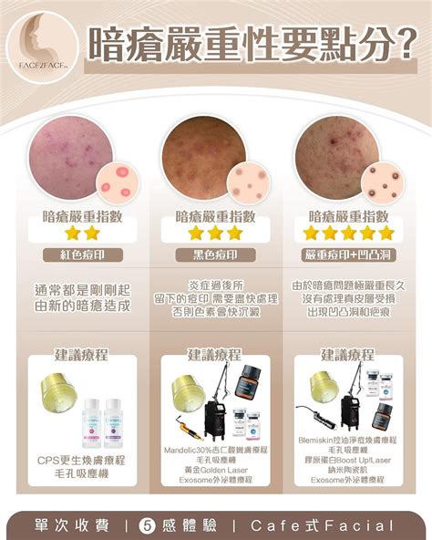 單次收費美容中心·屯門 ｜𝐂𝐚𝐟𝐞 𝐅𝐚𝐜𝐢𝐚𝐥｜專業激光去斑｜鋼筋索指定治療中心 Btl膠原槍官方認證治療中心無分店 🍀🍀🍀🍀🍀🍀 新客優惠： 😍😍新客買 送 優惠😍😍 😍😍