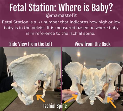 What Is Fetal Station The 3 Pelvic Levels Explained Mamastefit