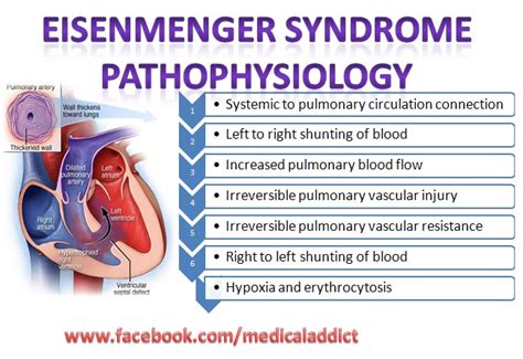 Medical Addicts Eisenmenger Syndrome Pathophysiology