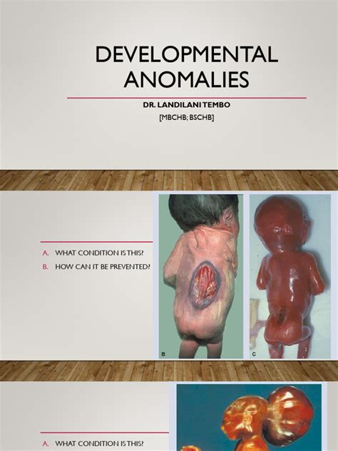 Developmental Anomalies Pdf