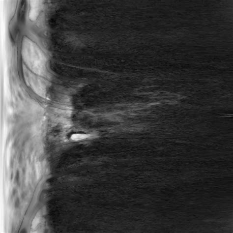 Rnfl Classification Dataset By Snigdha2823