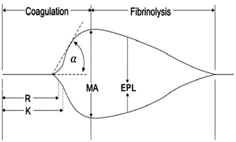 Hemodilution Is Not Critical In The Pathogenesis Of The Acute