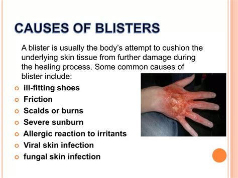 Blister First Aid Pptx