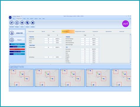 Morphology Results Ht Casa