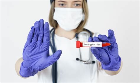 Scrub Typhus Claims 5 Lives 700 Infected All You Need To Know About