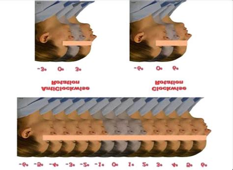 A Profile Pictures Showing One Degree Rotation In Clockwise And