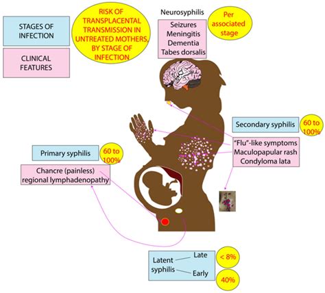 Understanding Congenital Syphilis Causes Symptoms And Treatment