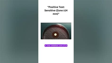 Optochin Test A Simple Way To Identify Pneumococcus Optochintest Streptococcuspneumoniae