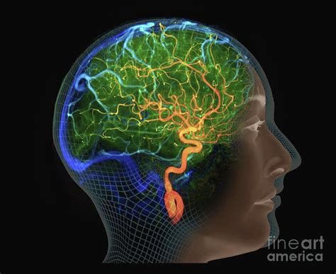 Normal Brain 9 Photograph By Zephyrscience Photo Library Fine Art