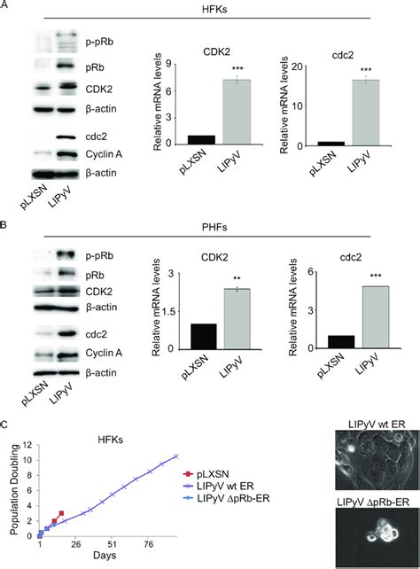 Lipyv Er Alters Prb Function In Cell Cycle Control A And B Protein