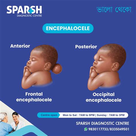 Encephalocele Causes Symptoms Diagnosis And Treatment Sparsh Diagnostic Center