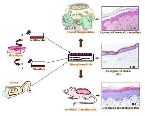 Bioengineered Skin Pdf Download Available