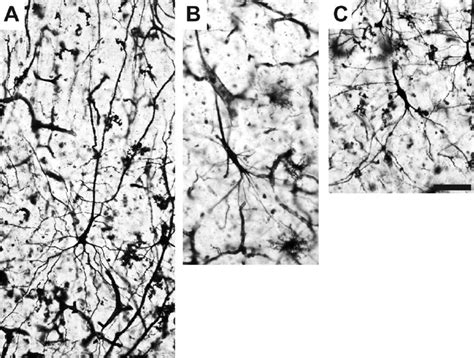 Photomicrographs Of A Golgi Impregnated Large Magnopyramidal Neuron Of