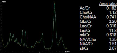Single Voxel Spectroscopy With A Voxel Of 16 Mm 3 Centered On The Brain