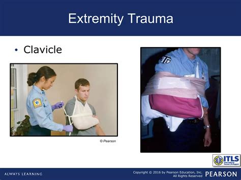Chapter14 Extremity Trauma Ppt