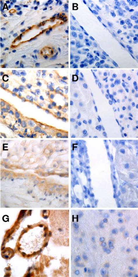 Staining Of Human And Murine Tissues For Nucleolin And Calreticulin