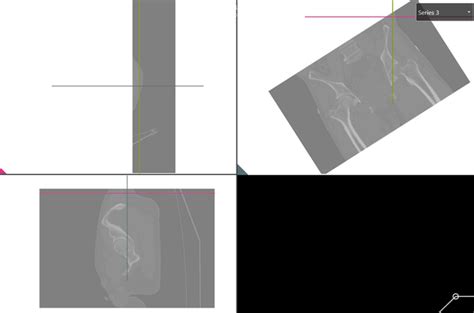 forwardinteractor · issue 6 · termijn dicom viewer · github