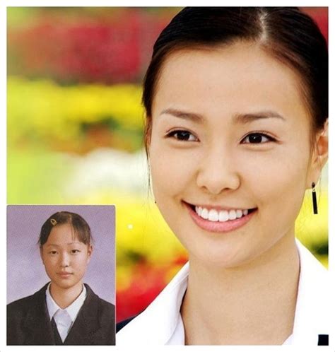 손태영 과거성형모습 전후 네이버 블로그