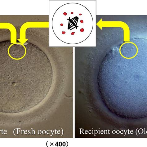 Spindle Chromosome Of Aged Oocyte Was Transferred Into The Enucleated