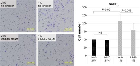 Transwell Migration Assay Saos2 Cells Stained With Diff Quick Solution