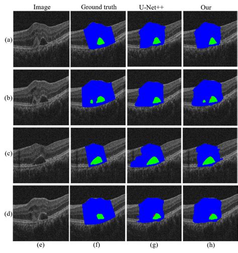 Comparison The Segmentation Results Between U Net And Our Models Download Scientific Diagram