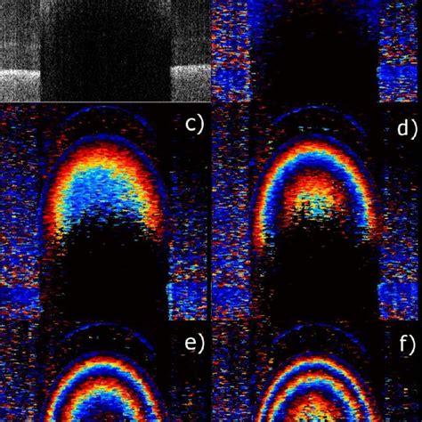 Schematic Of The Thorlabs Ocmp1300ss Swept Source Oct Doct System Key