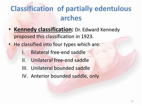01 Introduction And Classification Partial Denturepptx