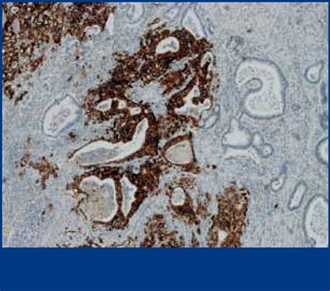 Figure 2 From Belgian Guidelines For Her2 Testing In Gastric Cancer Semantic Scholar