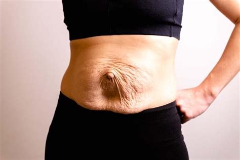 Toning Stomach After C Section