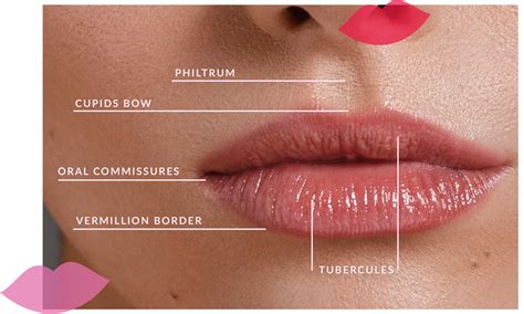 Cupid Lift® Deep Plane Upper Lip Lift What Is The Cupid Lift