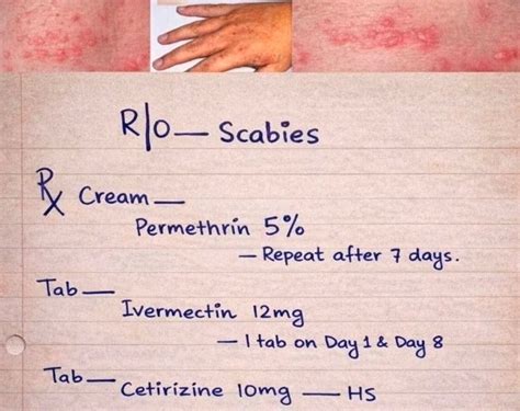 The Image Shows A Medical Prescription For Scabies It Includes R O S