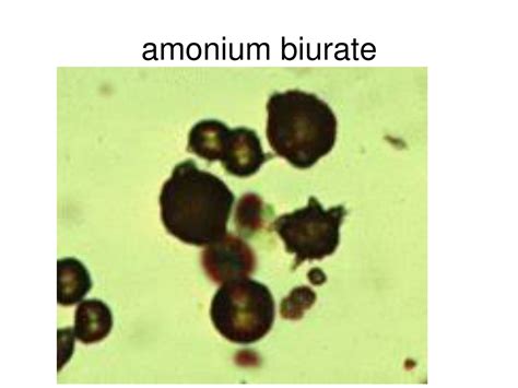 Ppt Urine Analysis Powerpoint Presentation Free Download Id8706530