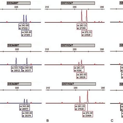 Quantitative Fluorescence Pcr Analysis Of Str Markers For X And Y